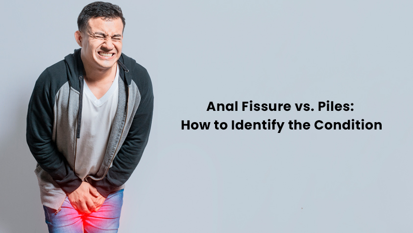 Anal Fissure vs Piles How to Identify the Condition - Saraja’s ...